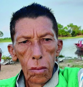 Alcantarillado de Saloa vierte aguas negras a la Ciénaga de Zapatosa ...